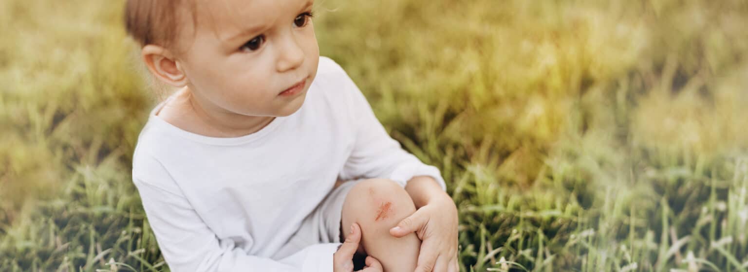 Contusioni ed ematomi nei bambini: cosa fare | In Salute